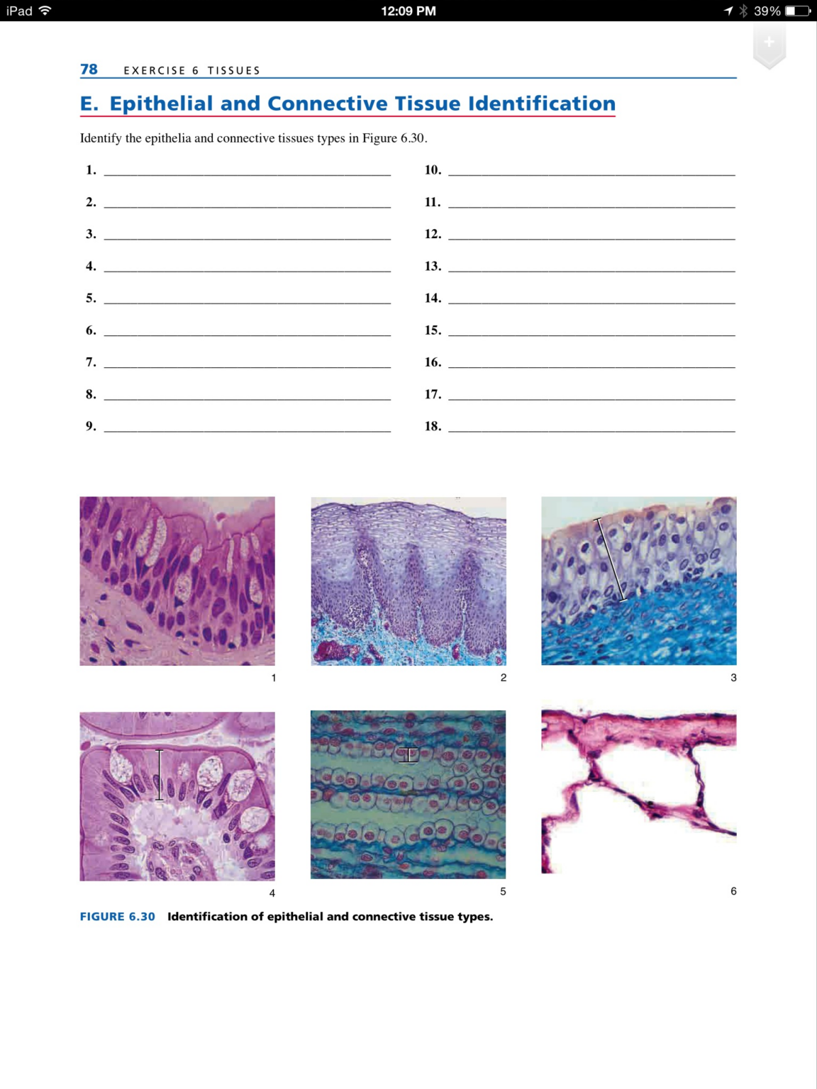 Epithelial Tissue Practice Printable | Anatomy Worksheets